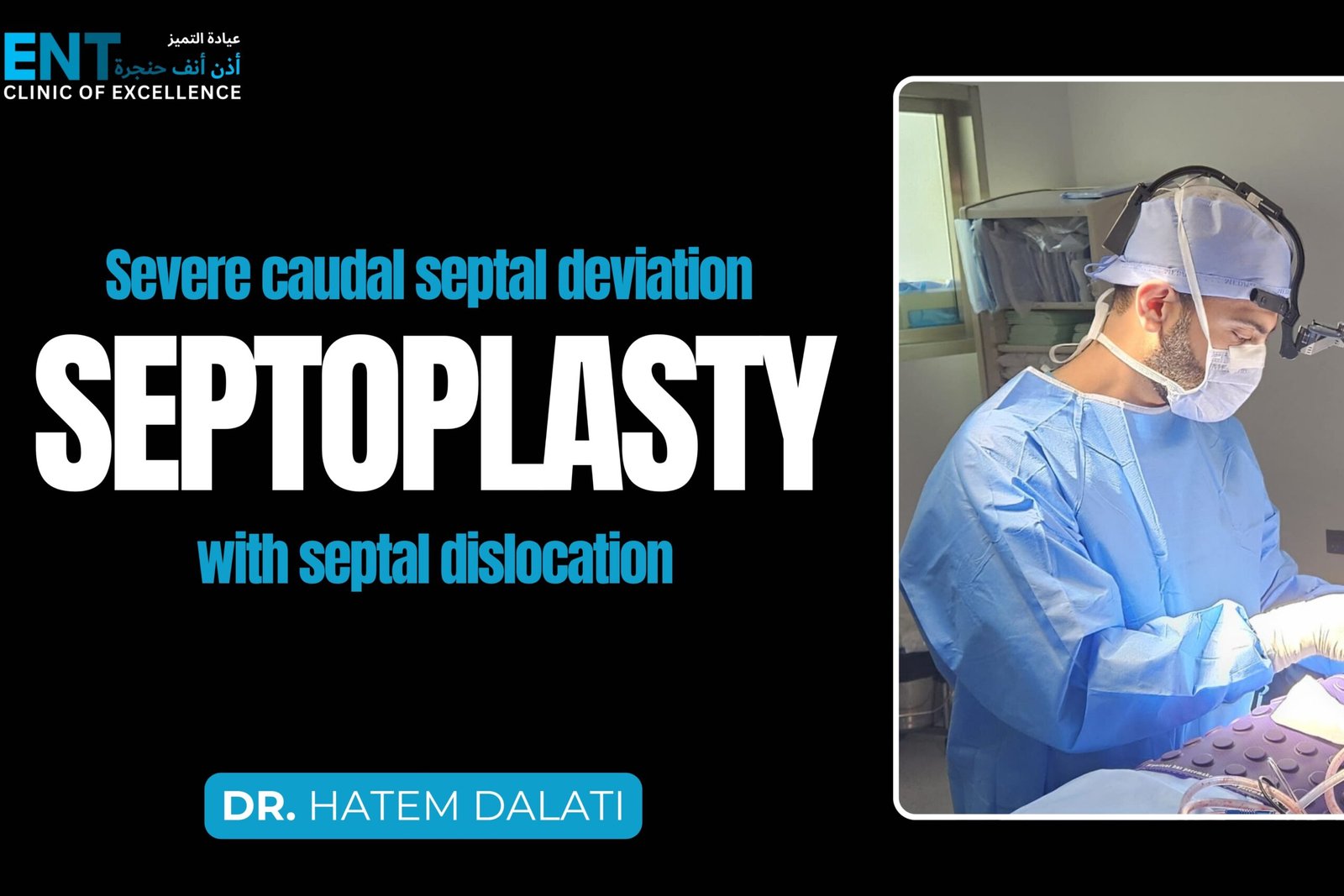 Caudal Septal Deviation with Septal Dislocation & Turbinate Reduction 👃 ...